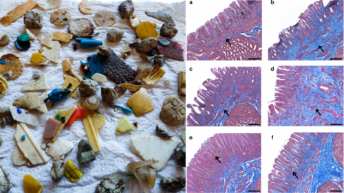 evidence-for-horrifying-new-disease-linked-to-plastic-consumption-in