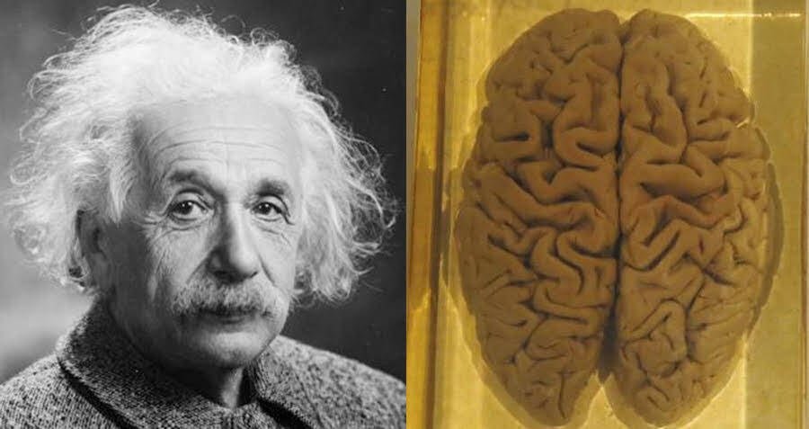 Albert Einstein Real Brain