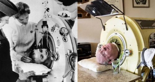 Meet Paul Alexander, The Man Who’s Lived In An Iron Lung For 70 Years | Flipboard