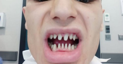 Model says 'it's like a horror movie' after Turkey teeth disaster ...