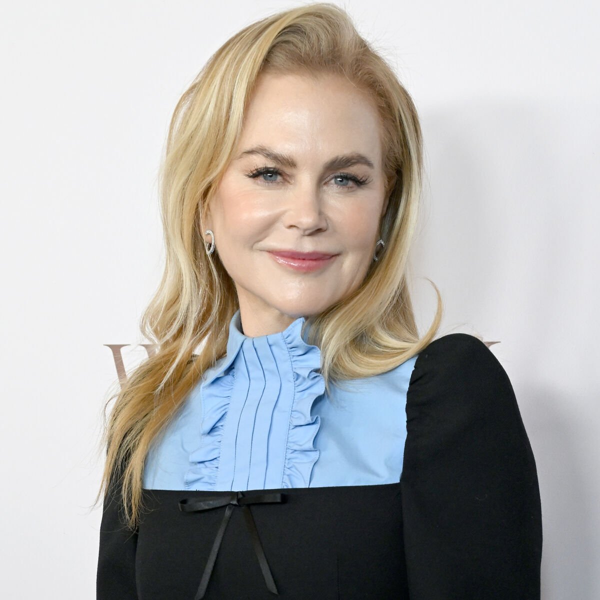 14 Side-By-Side Photos That Show The Dramatic Impact Of Plastic Surgery ...