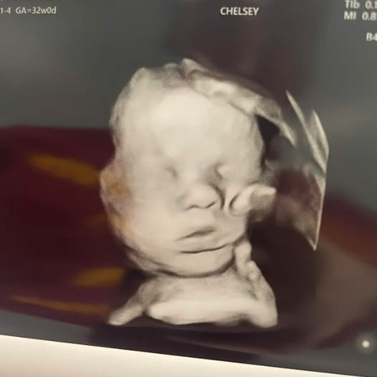 “Hand Of God” Seems To Appear In Ultrasound After Mom Prayed For The ...