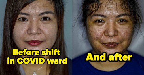 27 "Before And After" Photos That Left My Jaw Hanging Open - Flipboard