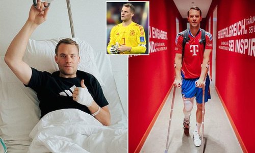 REVEALED: Manuel Neuer's boot 'held his horrific leg wound together ...