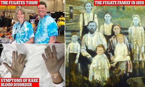 Inside the CENTURIES-long struggle of Kentucky's mysterious 'blue ...