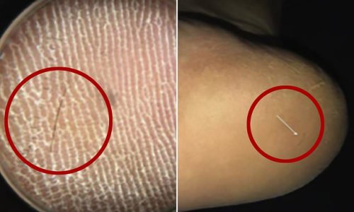 Man who suffered mystery agonising foot pain discovers it was because a ...