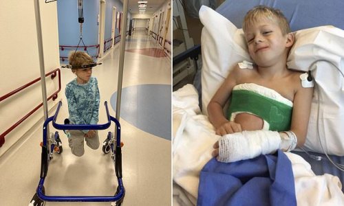 Boy, 11, with scoliosis finally gets to have surgery on his spine after ...