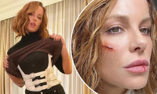 Kate Beckinsale slips into body harness and shows off bloodied lip as ...