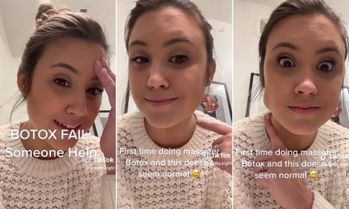 I had Botox injected into my jawline - now people are saying it looks ...