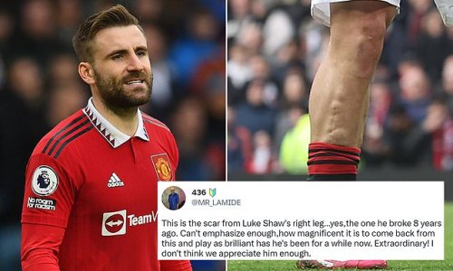 'Truly inspiring': Fans hail Luke Shaw's 'extraordinary' comeback from ...