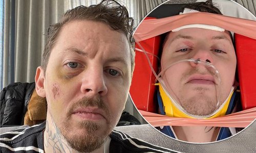 'I fell face-down onto steel and concrete!' Professor Green reveals he ...
