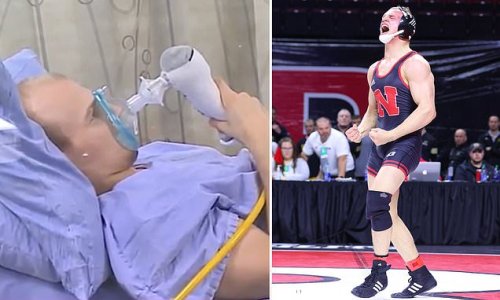 College Wrestler 23 Nearly Loses His Leg When Strange Bruise Turns