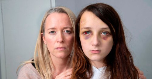 Mum of autistic girl 'beaten unconscious' in tears as youth violence ...