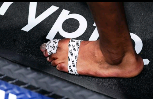 Jon Jones Reveals Toe Injury From Chael Sonnen That Delayed UFC 285 ...