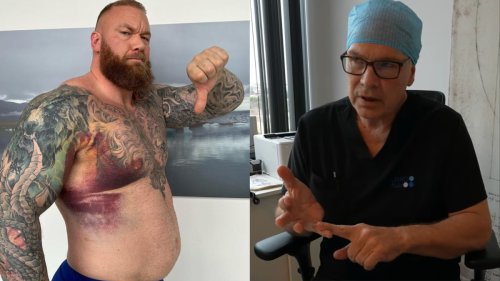 Hafthor Bjornsson Shares Doctor’s Update on Pec Tear Ahead of Surgery ...