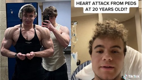 20-Year-Old Bodybuilder Mega Dosing Steroids Causes Heart Attack: ‘I ...