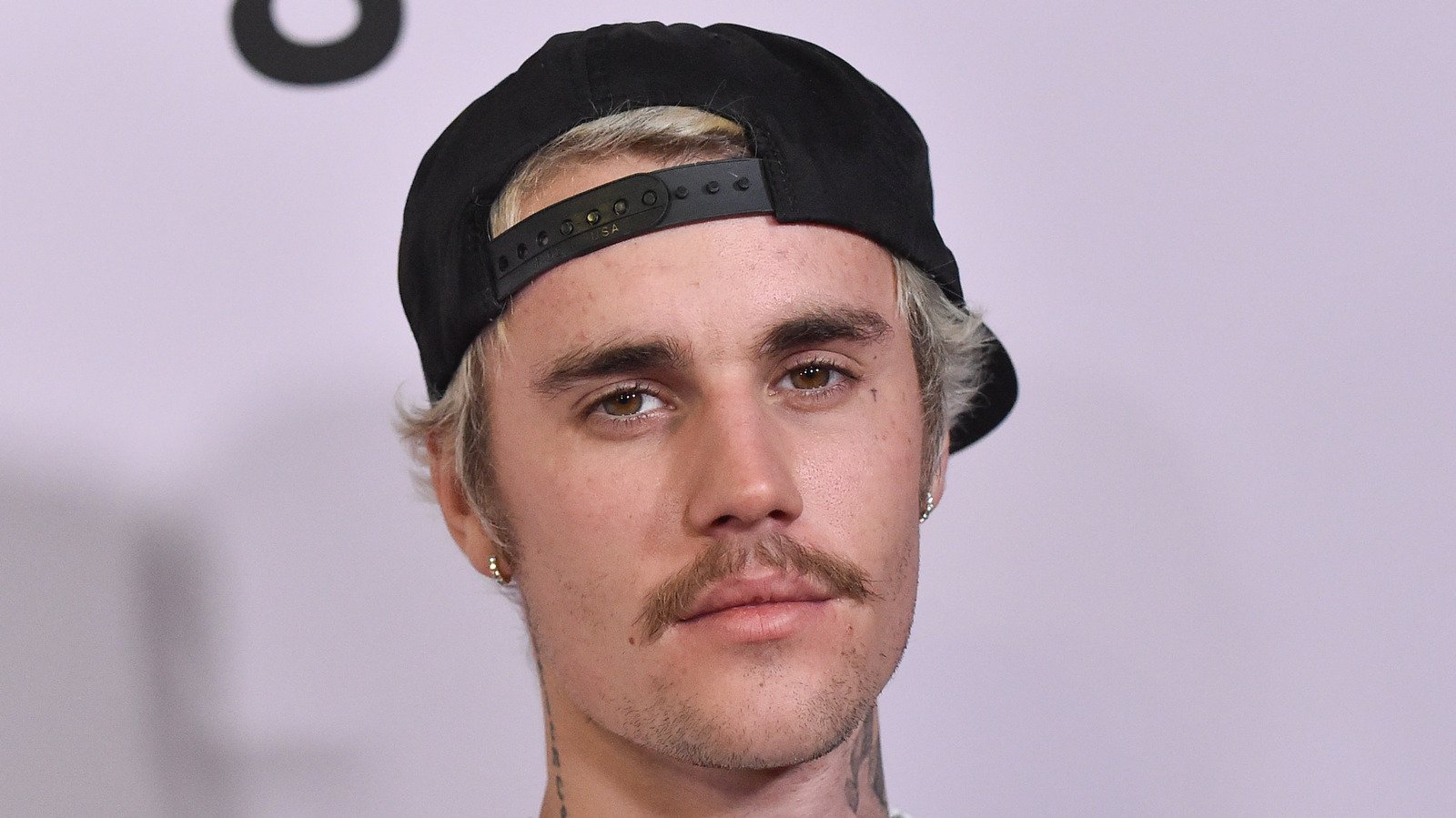 Justin Bieber's Ramsay Hunt Syndrome Diagnosis Explained | Flipboard