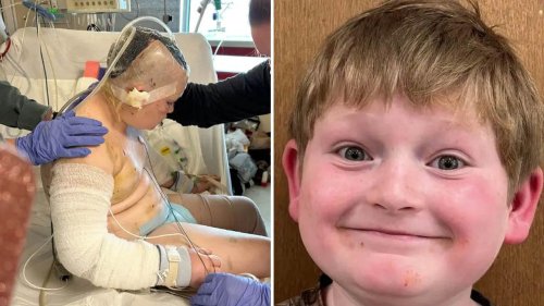 Facebook community rushes to aid Georgia boy who was mauled by three ...