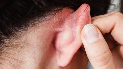 Why You Get Dry Skin Behind Your Ears And How To Treat It - Glam ...