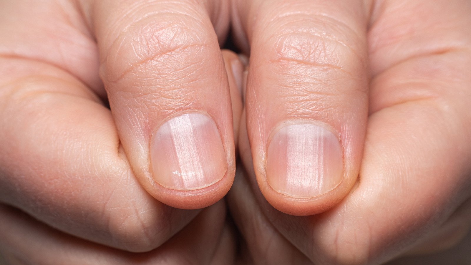 How To Get Rid Of Ugly Nail Ridges | Flipboard