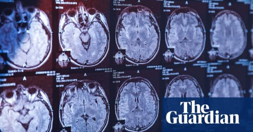 Scientists discover why humans have such big brains - Flipboard Scientists discover why humans have such big brains - Flipboard
