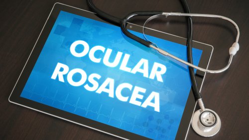 Everything You Need To Know About Ocular Rosacea Flipboard everything-you-need-to-know-about-ocular-rosacea-flipboard