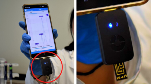 No More Lab Queues: Smartphone Integrated Diagnostic Tool Gives Rapid ... No More Lab Queues: Smartphone Integrated Diagnostic Tool Gives Rapid ...