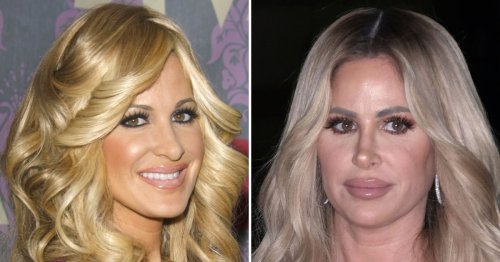 Did Rhoas Kim Zolciak Get Plastic Surgery See Then Now Photos