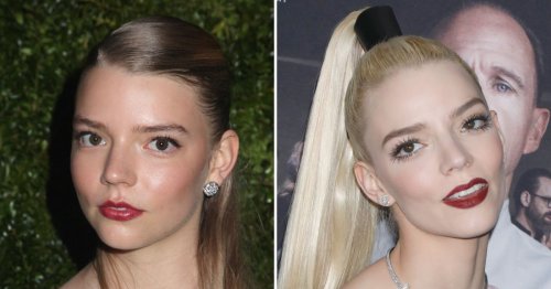 Did Anya Taylor-Joy Ever Get Plastic Surgery? See Transformation Photos ... Did Anya Taylor-Joy Ever Get Plastic Surgery? See Transformation Photos ...