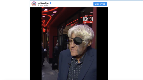 Jay Leno shows off bruised face after falling 60 feet. ‘Fell 60 feet ...