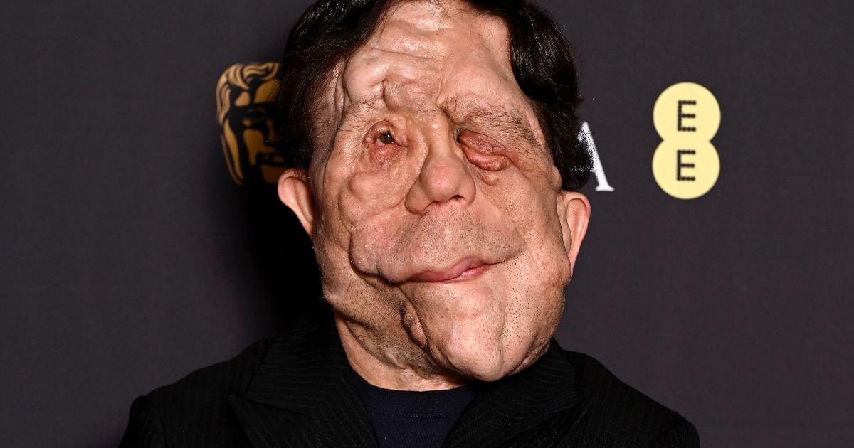 BAFTA nominee Adam Pearson slams social media troll over appearance ...