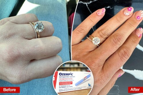 Ozempic finger is diet drug’s latest side effect — forcing women to ...