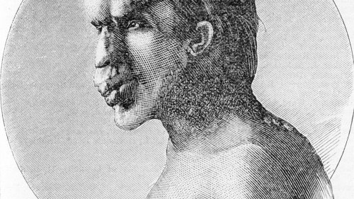 The devastating true story of Elephant Man, Joseph Merrick | Flipboard