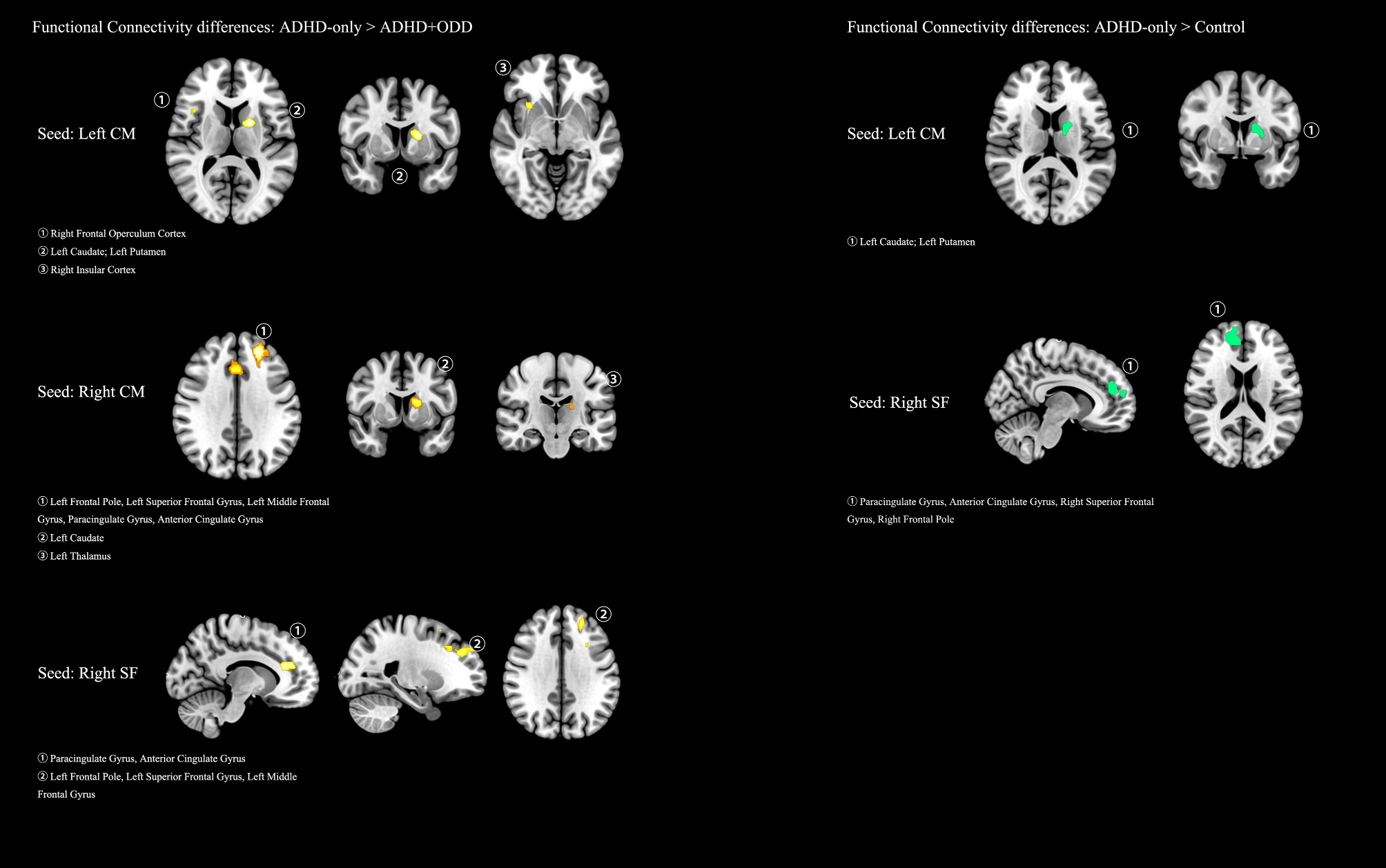 Functional And Structural Connectivity Of The Subregions Of The