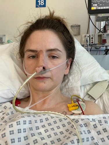 London NHS trust apologises after woman suffers severe damage during ... London NHS trust apologises after woman suffers severe damage during ...