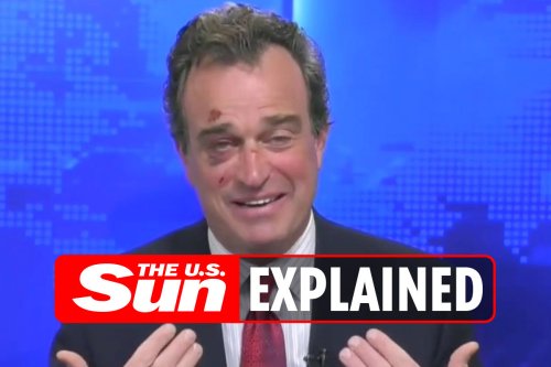 Why does Charlie Hurt have a black eye? | Flipboard