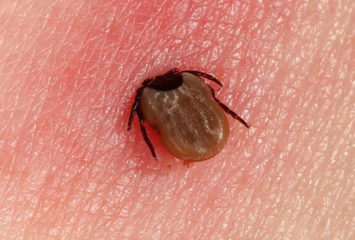 Identifying a Tick Bite From Pictures | Flipboard
