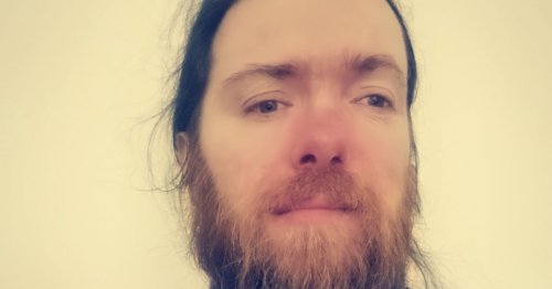 Welsh man says the way he looks is stopping him from getting a job ...