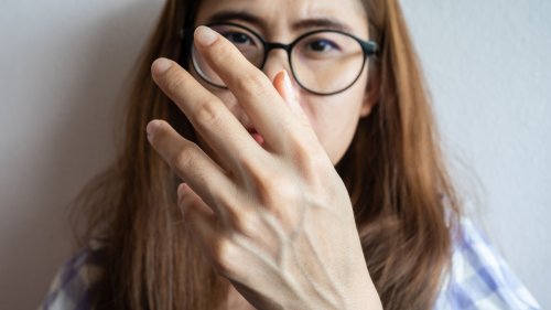 When Are Bulging, Veiny Hands a Cause For Medical Concern? Here’s What You Need To Know | Flipboard